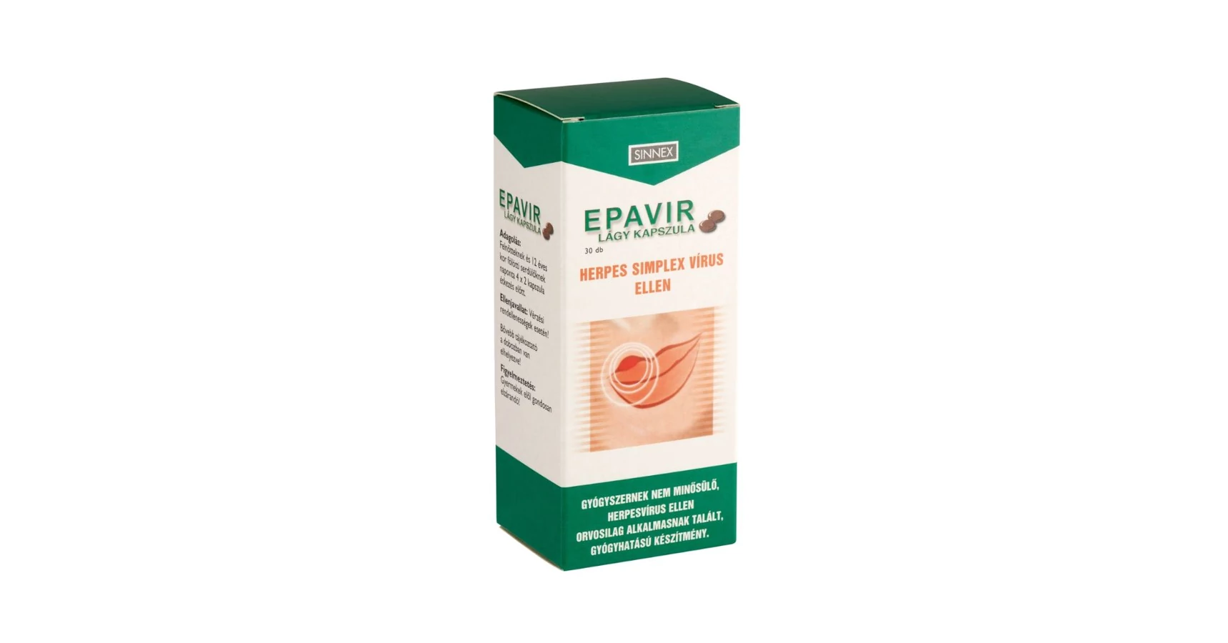 Epavir kapszula (30x) - Bőrproblémák